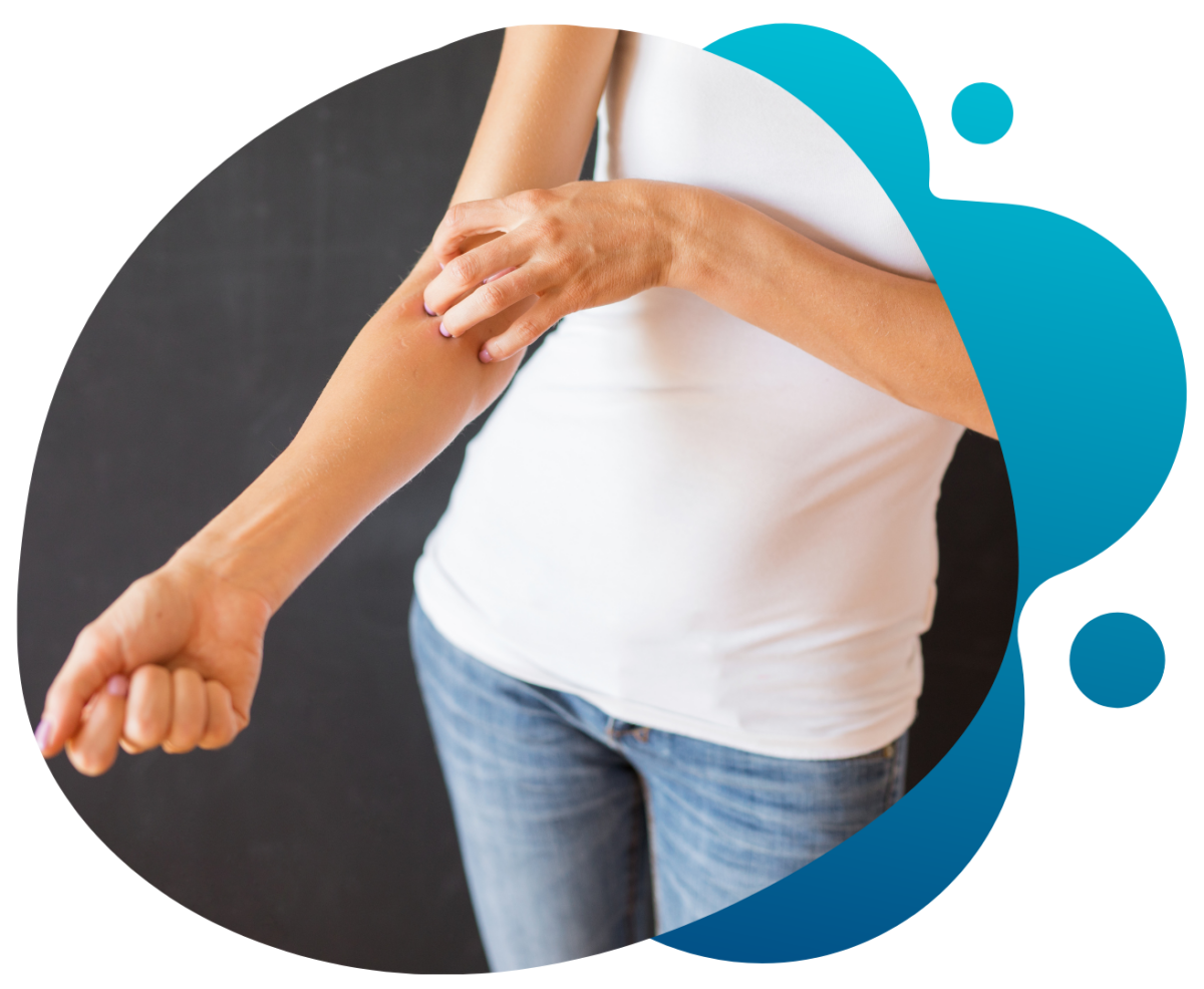 Dont Suffer In Silence Participate In Atopic Dermatitis Research